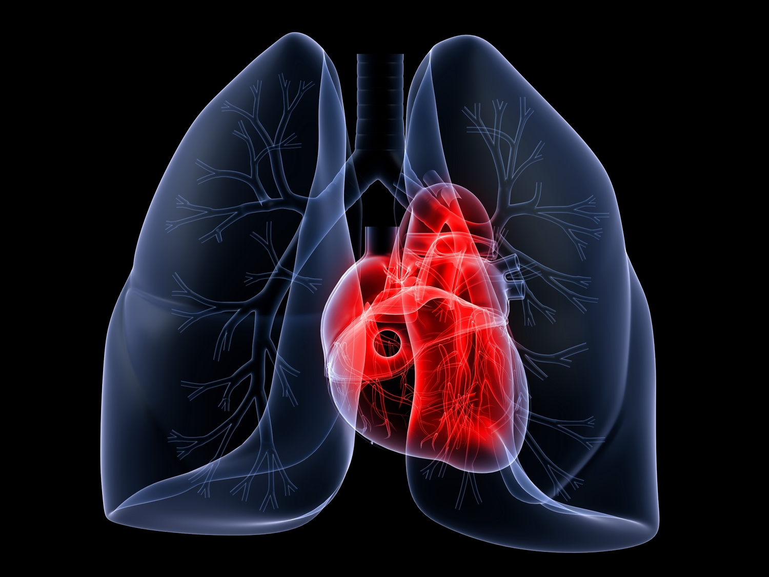 Pulmonary Artery Hypertension - Avens Blog | Avens Blog