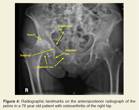 Full Text Article :: A Systematic Approach to Evaluating Hip ...