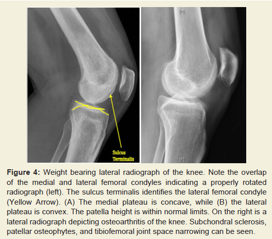 JOR-2334-2846-01-0007-thumbfig4